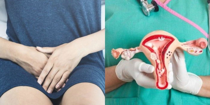 Punca Kanser Ovari, Jenis, Simptom, Diagnosis Dan Rawatan