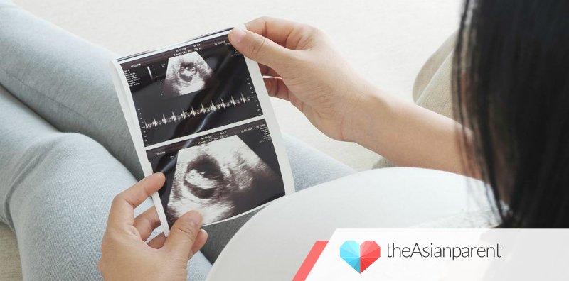 Scan Kehamilan Untuk Memantau Perkembangan Janin Dalam Perut Ibu