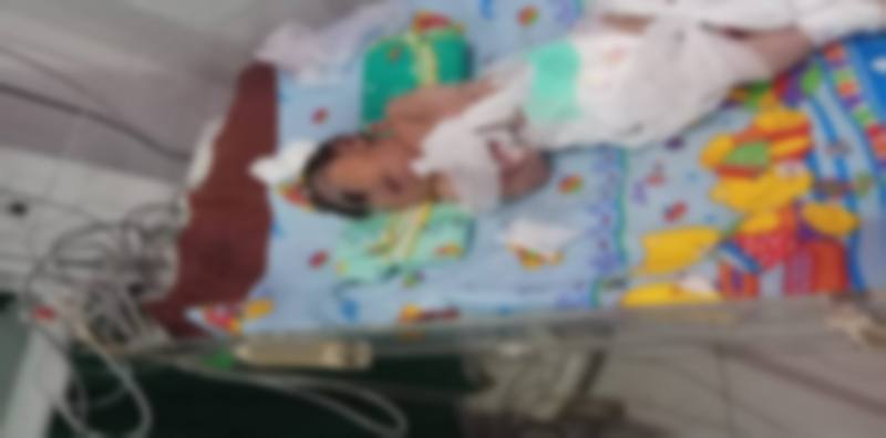 Bayi Mata Satu Tanpa Hidung Lahir Kerana Keracunan Merkuri