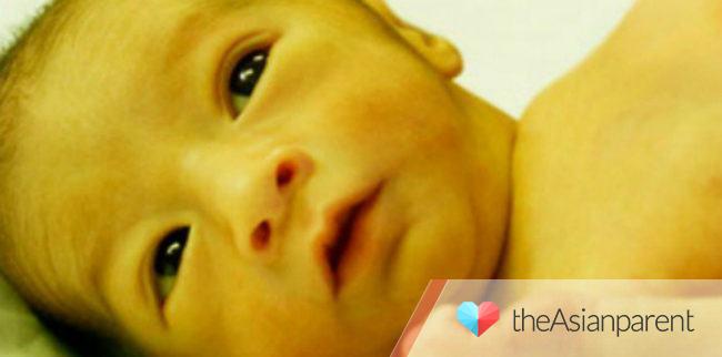 Cara Hilangkan Kuning Bayi - Rawatan Yang Sesuai Disyorkan Doktor