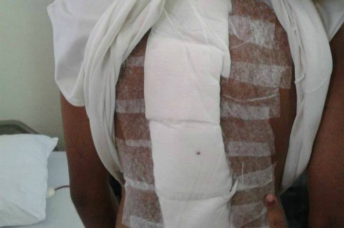 Heavy School Backpack Can Do Irreversible Damage To Your Child