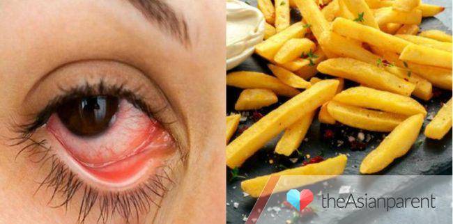 Mata Buta Gara-Gara Terlalu Banyak Ambil Makanan Proses Sejak Kecil