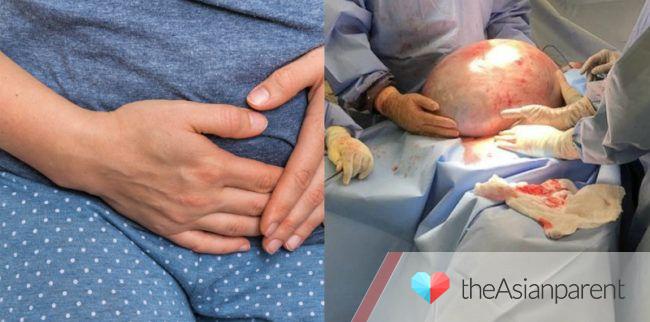 Cyst Ovari Semasa Hamil, Apakah Punca & Gejala Pertumbuhan Cyst?