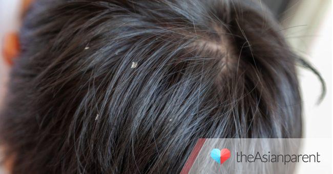 Toddler Dandruff: Causes, Symptoms and Remedies