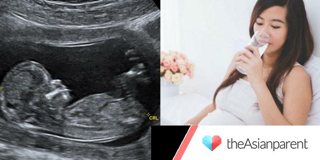 Scan Jantina Bayi Dengan Tepat Dan Mudah, Ini Tips Yang Boleh Dicuba