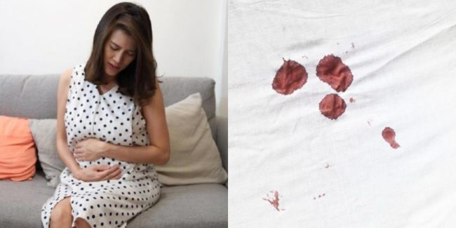 Pendarahan Awal Kehamilan Normal Atau Tidak?