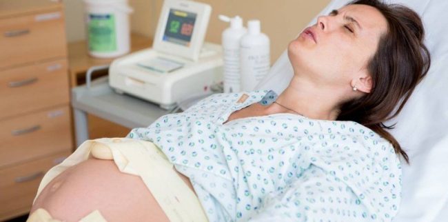 Pengalaman Ibu Bersalin Caesar, Masalah Bayi Terbelit Tali Pusat