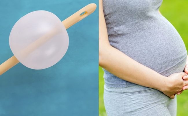 Induce Belon Diguna Untuk Percepatkan Bukaan, Sakit Atau Tidak?