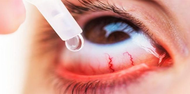 Ubat Mata Terbaik, Ini 8 Pilihan Bagus Rawat Pelbagai Masalah Mata