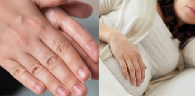 Kebas Tangan Ketika Hamil Kebiasaannya Berlaku Pada Trimester Kedua