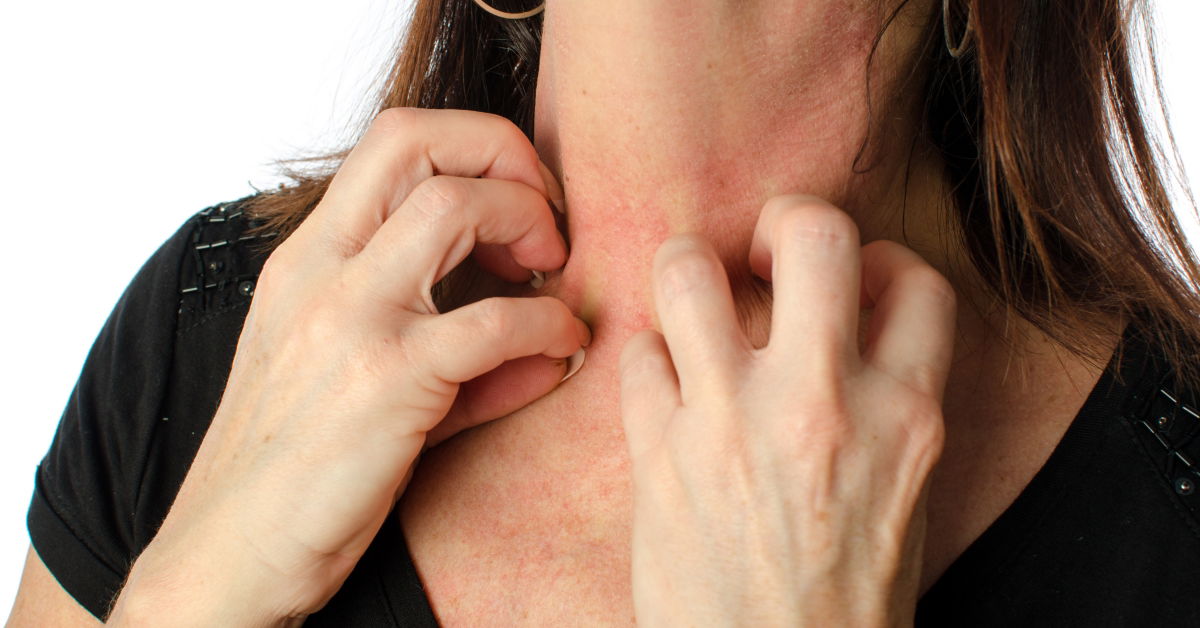 Alergik Kulit Masa Mengandung Boleh Mengancam Nyawa Ibu Hamil