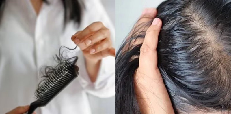 Shampoo Untuk Rambut Gugur, 8 Pilihan Ibu Selepas Bersalin