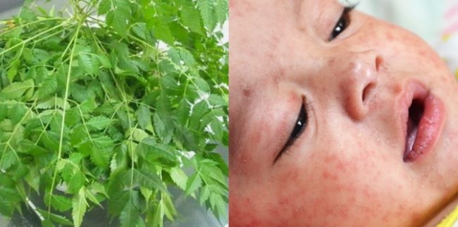 Daun Semambu Untuk Demam Campak, Ini Cara Membuatnya
