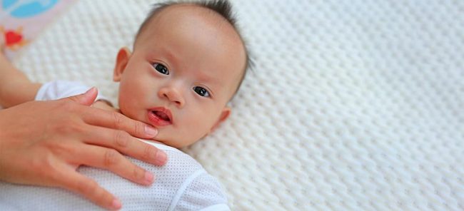 Bibir Bayi Hitam, Parents! Jangan Risau, Ini Apa Anda Perlu Tahu