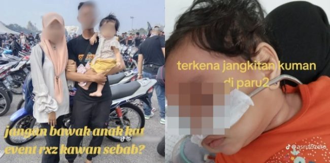 Anak Terhidu Asap Motor RXZ Member, Kena Jangkitan Paru-Paru